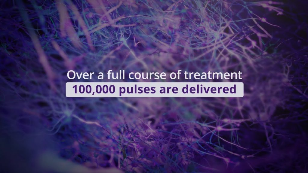 TMS Therapy - focusandbalance